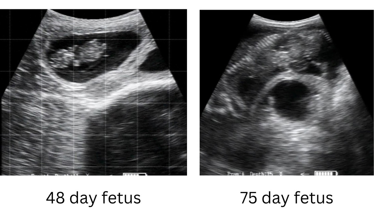 Pregchecking—Think Ahead and Set Up for Success | Ag Proud